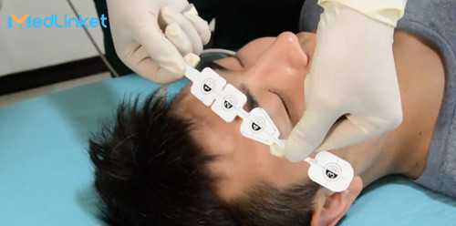 How is MedLinket’s disposable non-invasive EEG sensor different from ...